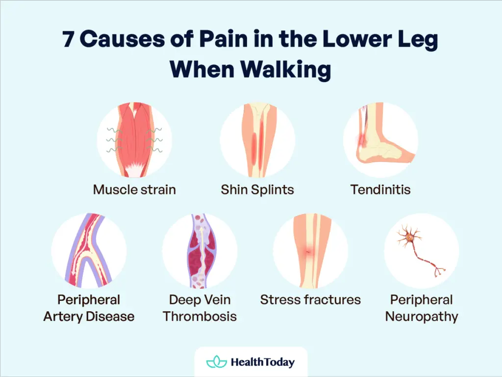 7 Causes of Lower Leg Pain When Walking, Symptoms, and Treatments ...
